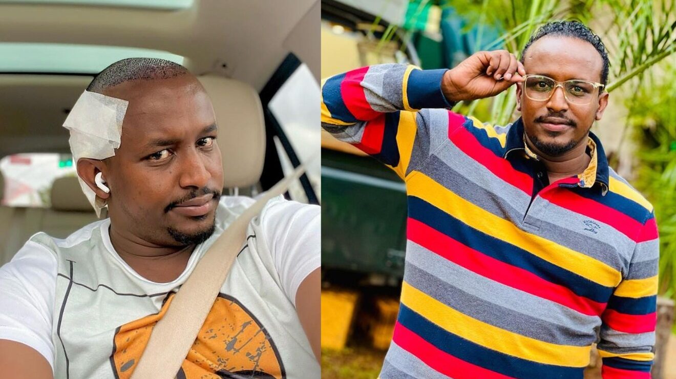 Jamal Rohosafi undergoes yet another plastic surgery – Nairobi News